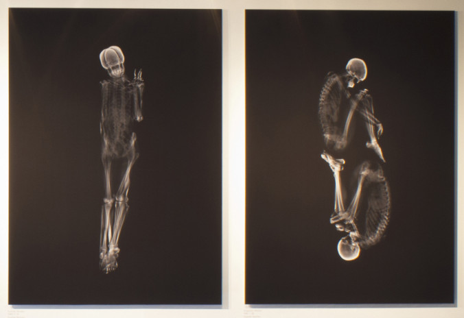 X-Ray Portraits of Couples by Saiko Kanda and Mayuka Hayashi | Spoon ...